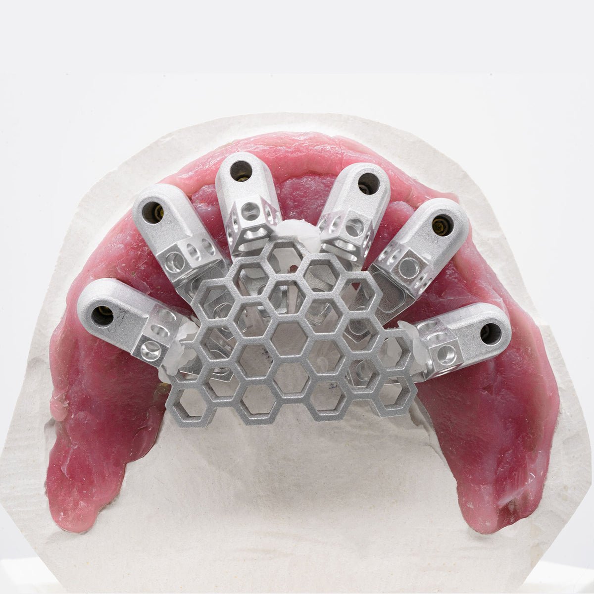 Grammetry OptiSplint Single-Arch Pack– ROE Dental Laboratory