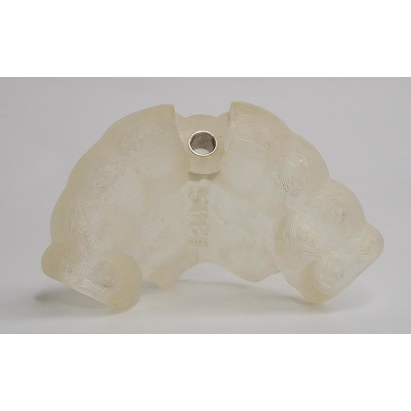 Simplant Surgical Guide (Single)– ROE Dental Laboratory