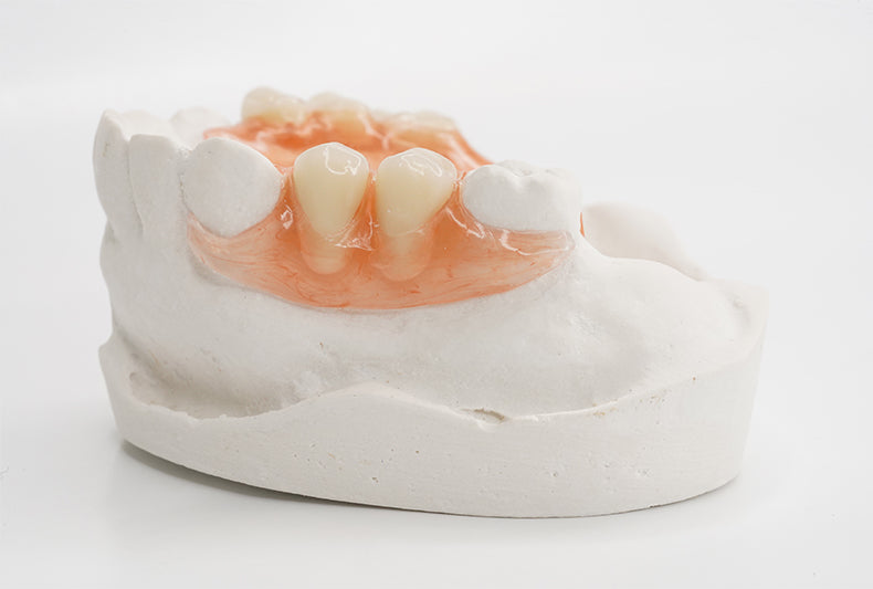 Valplast Partial (Lower)– ROE Dental Laboratory