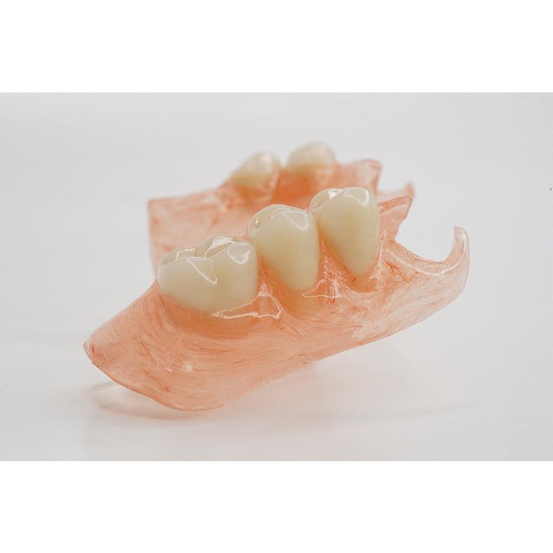 Valplast Partial (Upper)– ROE Dental Laboratory