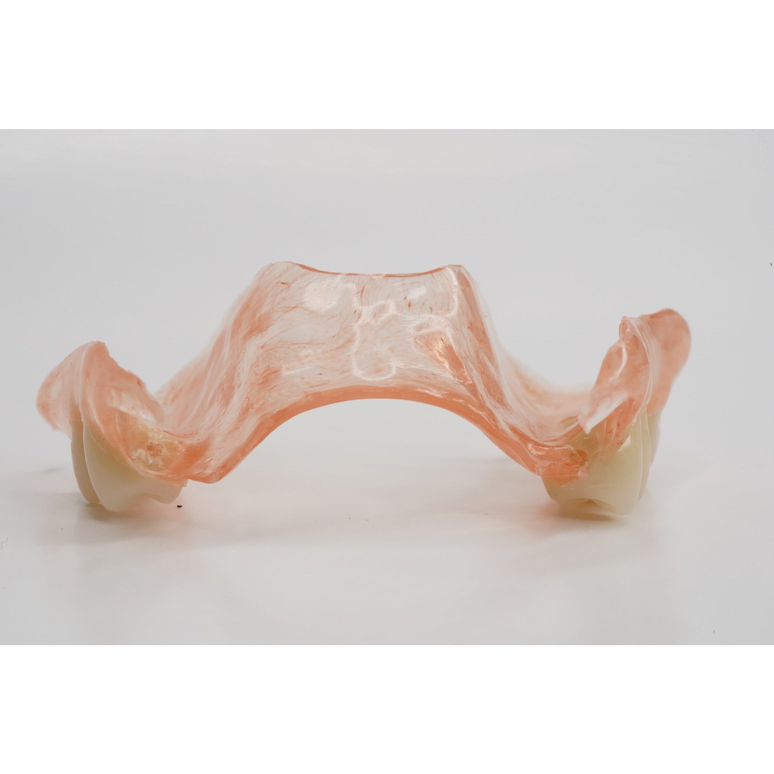 Valplast Partial (Upper)– ROE Dental Laboratory