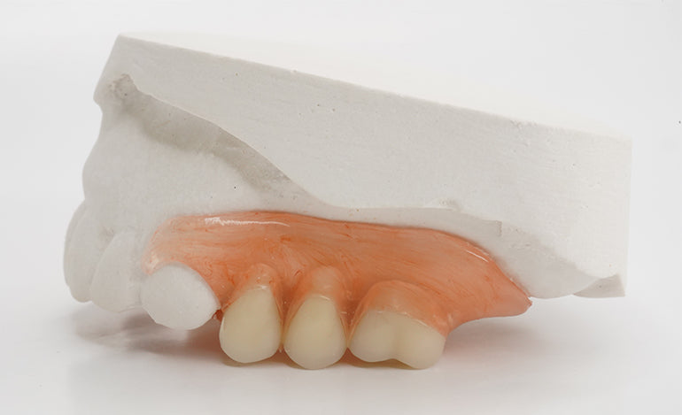 Valplast Partial (Lower)– ROE Dental Laboratory