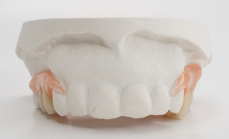 Valplast Partial (Lower)– ROE Dental Laboratory