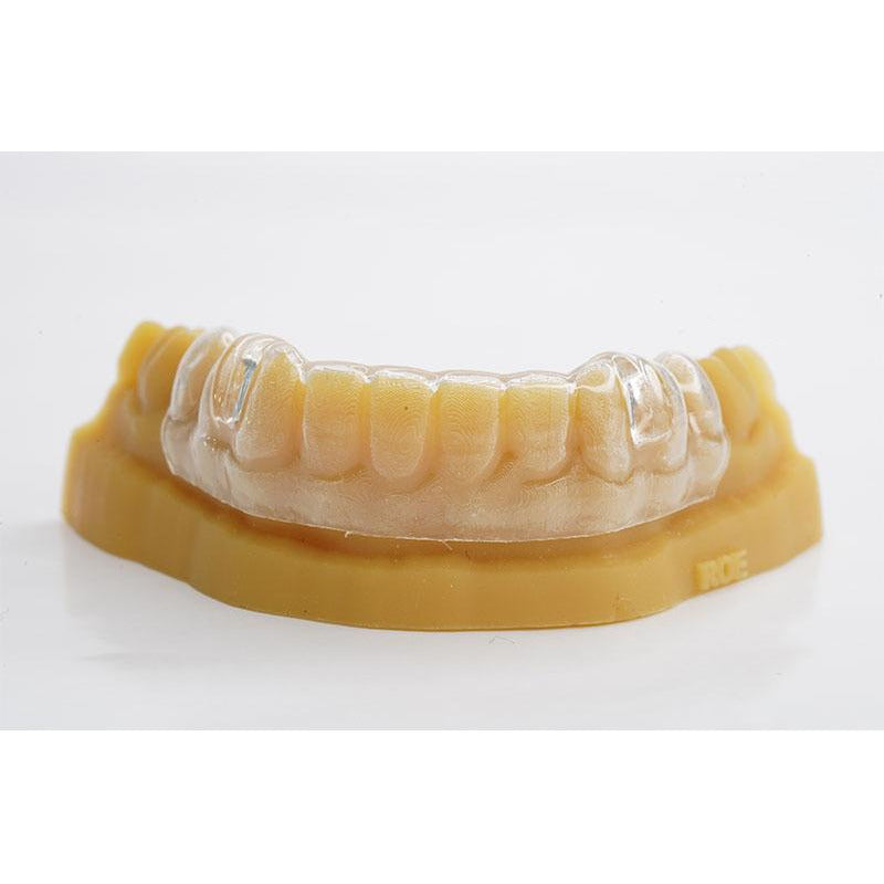 miniComfort® Guard with Model– ROE Dental Laboratory