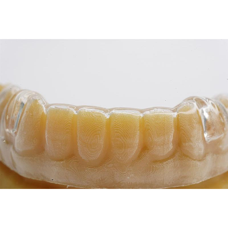 miniComfort® Guard with Model– ROE Dental Laboratory