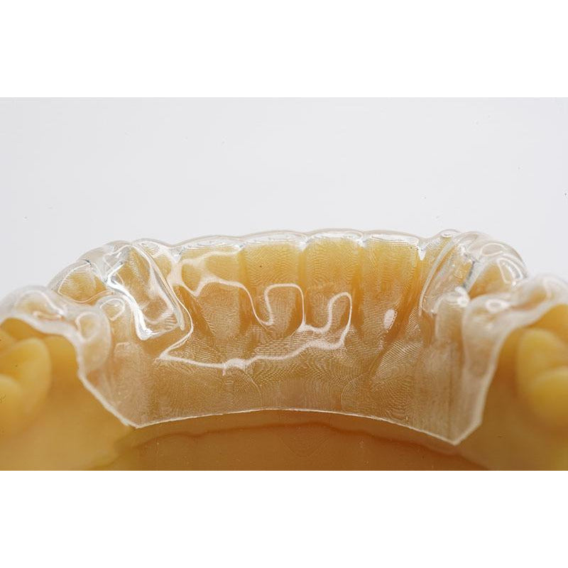 miniComfort® Guard with Model– ROE Dental Laboratory