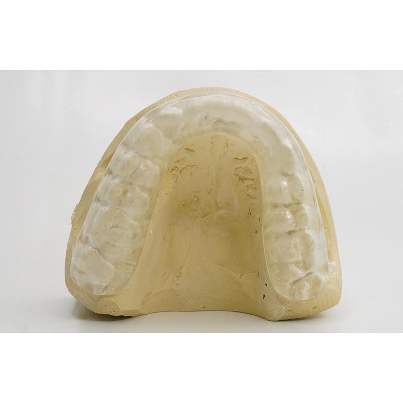Eclipse Splint with Model (Maxilla)– ROE Dental Laboratory