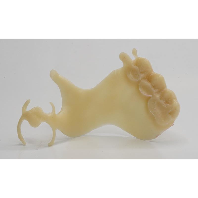 Acetal Frame (Maxilla)– ROE Dental Laboratory