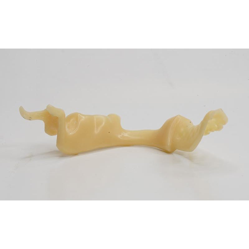 Acetal Frame (Maxilla)– ROE Dental Laboratory