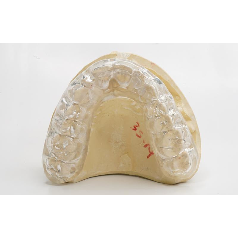 Eclipse Splint (Maxilla)– ROE Dental Laboratory