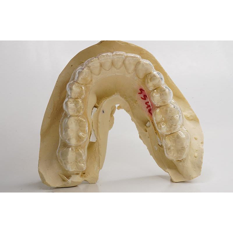Essix Retainer with Model (Mandible)– ROE Dental Laboratory