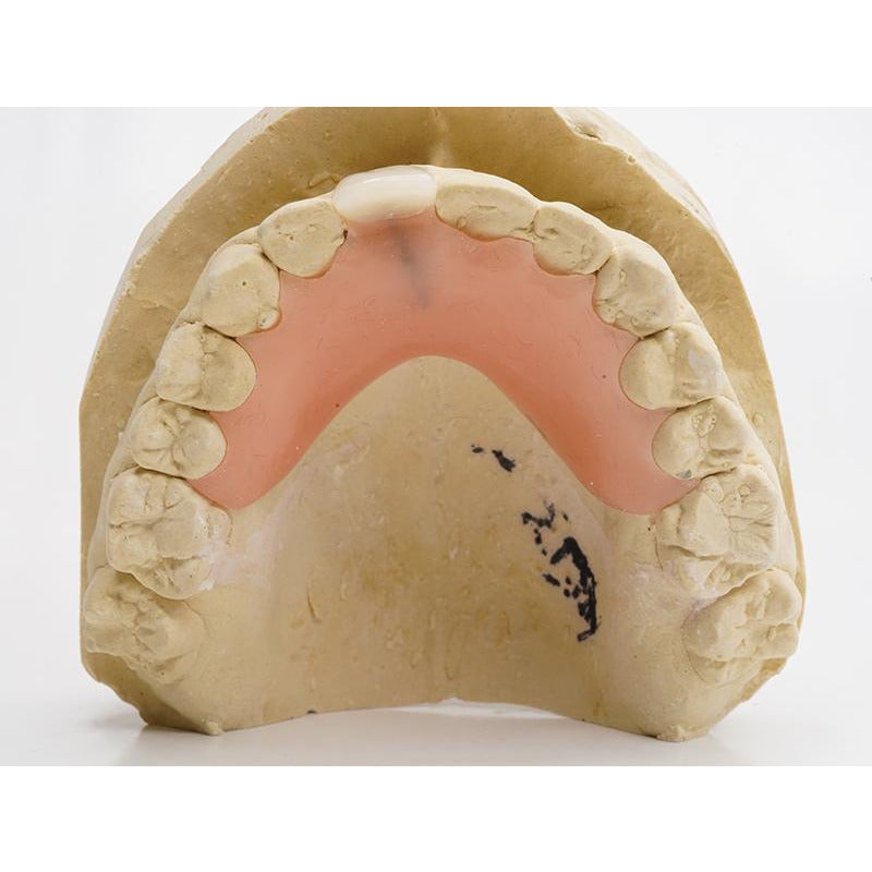 Metal Flipper #8– ROE Dental Laboratory