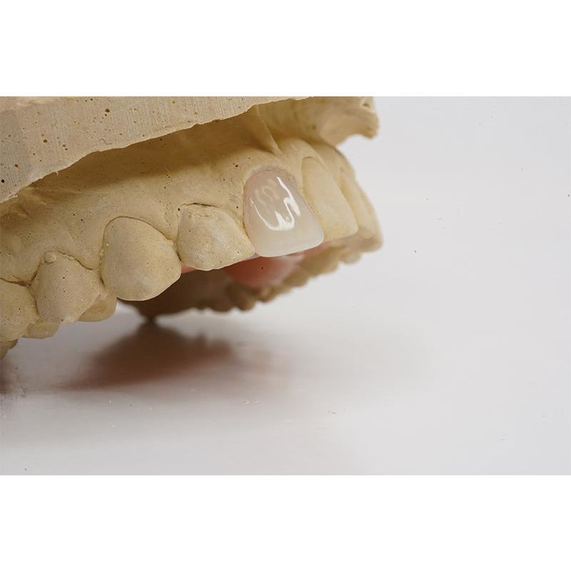 Metal Flipper #8– ROE Dental Laboratory