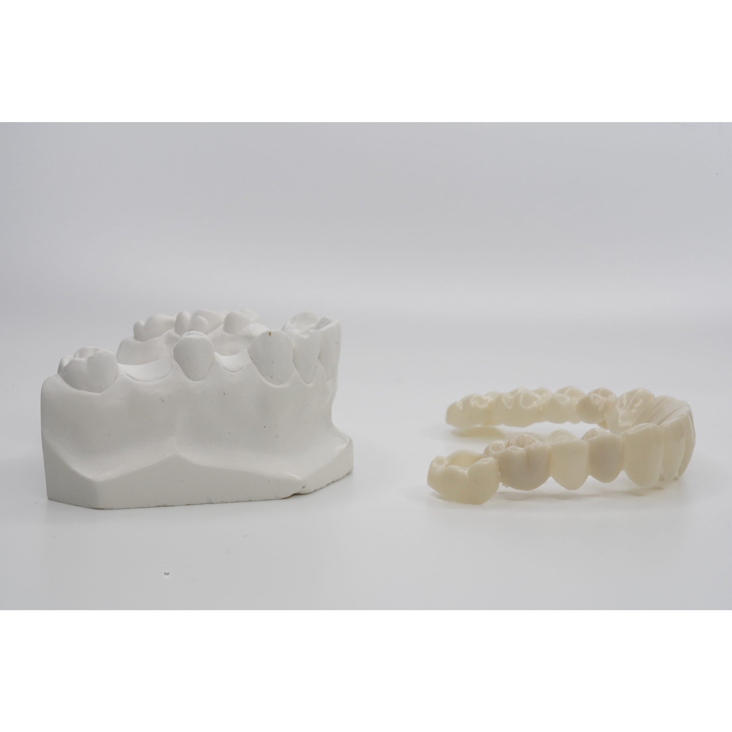 Snap-On Smile Partial– ROE Dental Laboratory