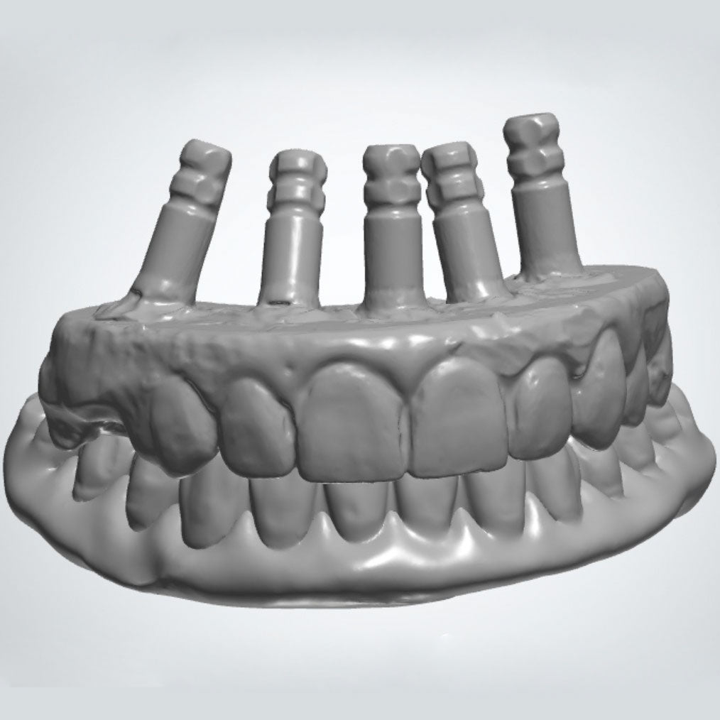 iJig Scan Bodies/Analogs– ROE Dental Laboratory